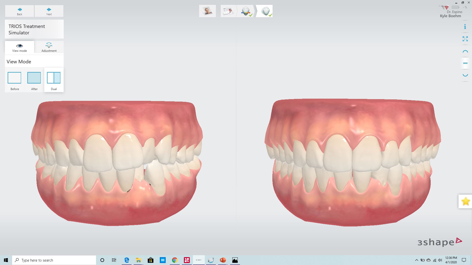 Riverview Dentist | Riverview Dental Arts | Trios Intra-Oral 3D Scanner